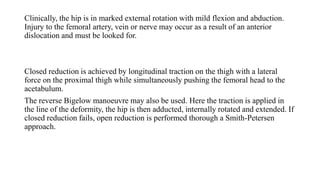 Hip Dislocation | PPTX