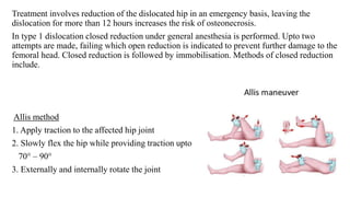 Hip Dislocation | PPTX