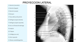 rx torax.pptx
