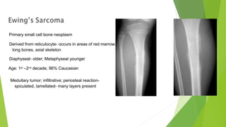 pediatric malignancy | PPTX