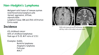 pediatric malignancy | PPTX