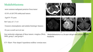 pediatric malignancy | PPTX