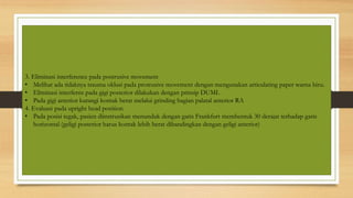 occlusal adjustment | PPTX