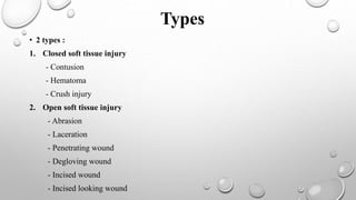 Management of soft tissue injury | PPTX
