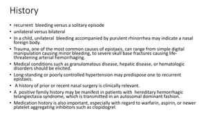 Epistaxis | PPT
