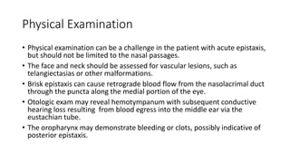 Epistaxis | PPT