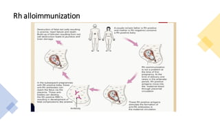 rh isoimmunization.pdf