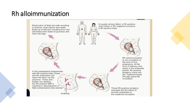 rh isoimmunization.pdf