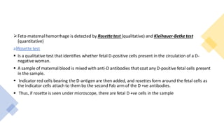 rh isoimmunization.pdf