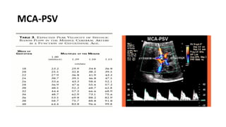 rh isoimmunization.pdf