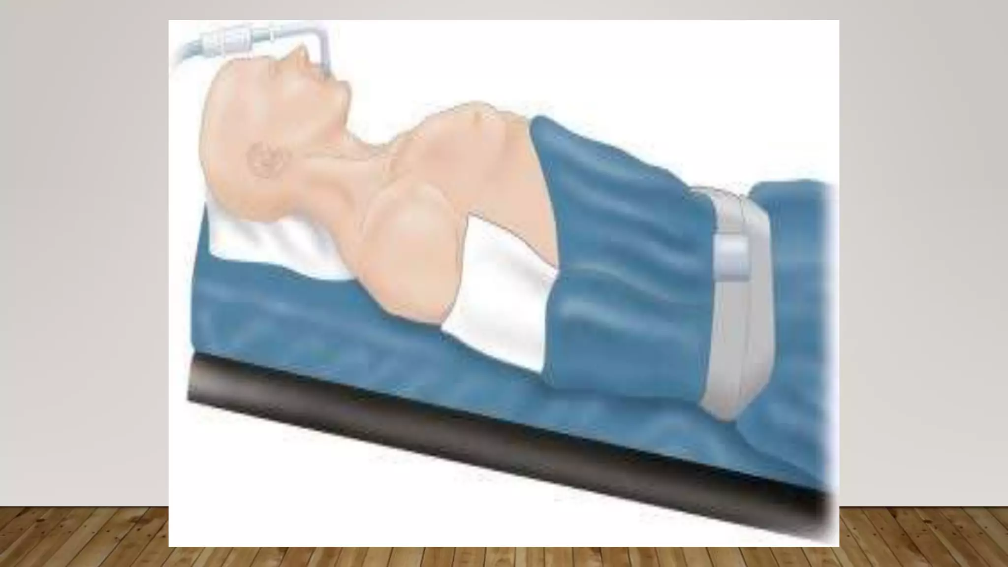 Anterior Cervical Corpectomy | PPTX