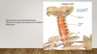 Anterior Cervical Corpectomy | PPTX