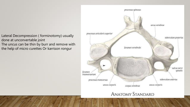Anterior Cervical Corpectomy | PPT