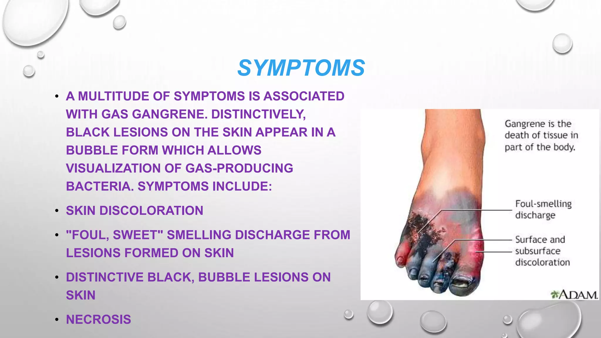 Gas Gangrene | PPTX