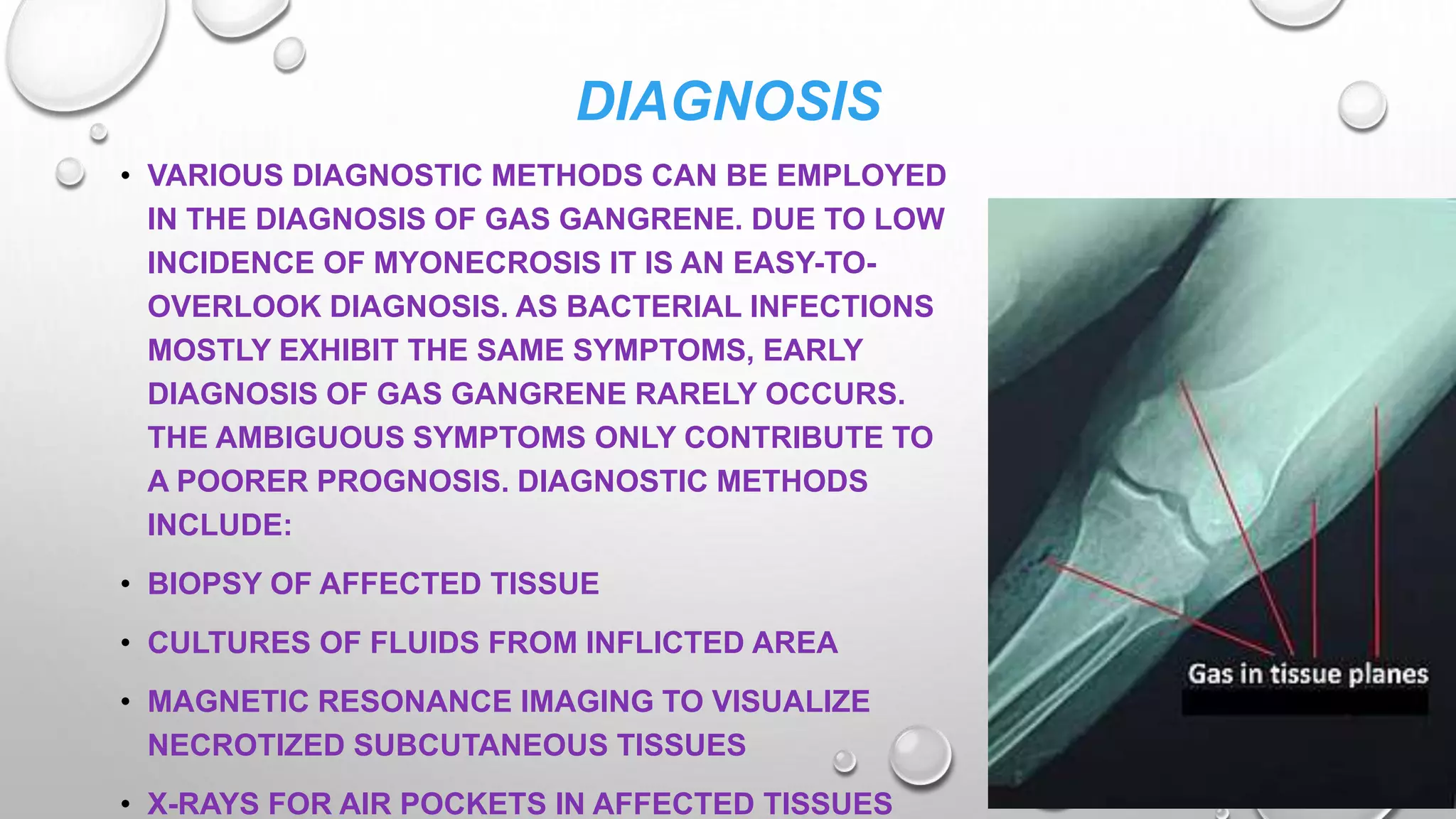 Gas Gangrene | PPTX