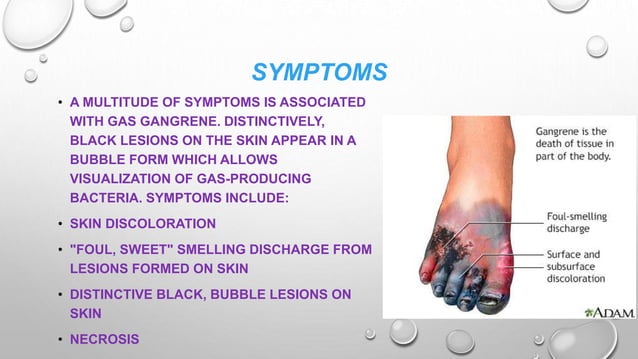 Gas Gangrene | PPT