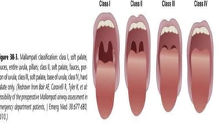 airway examination | PPTX