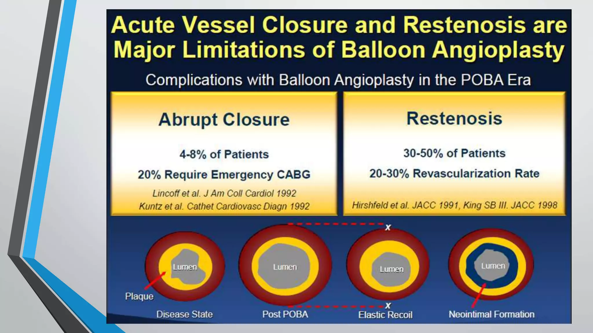 Cardiac Stents | PPTX