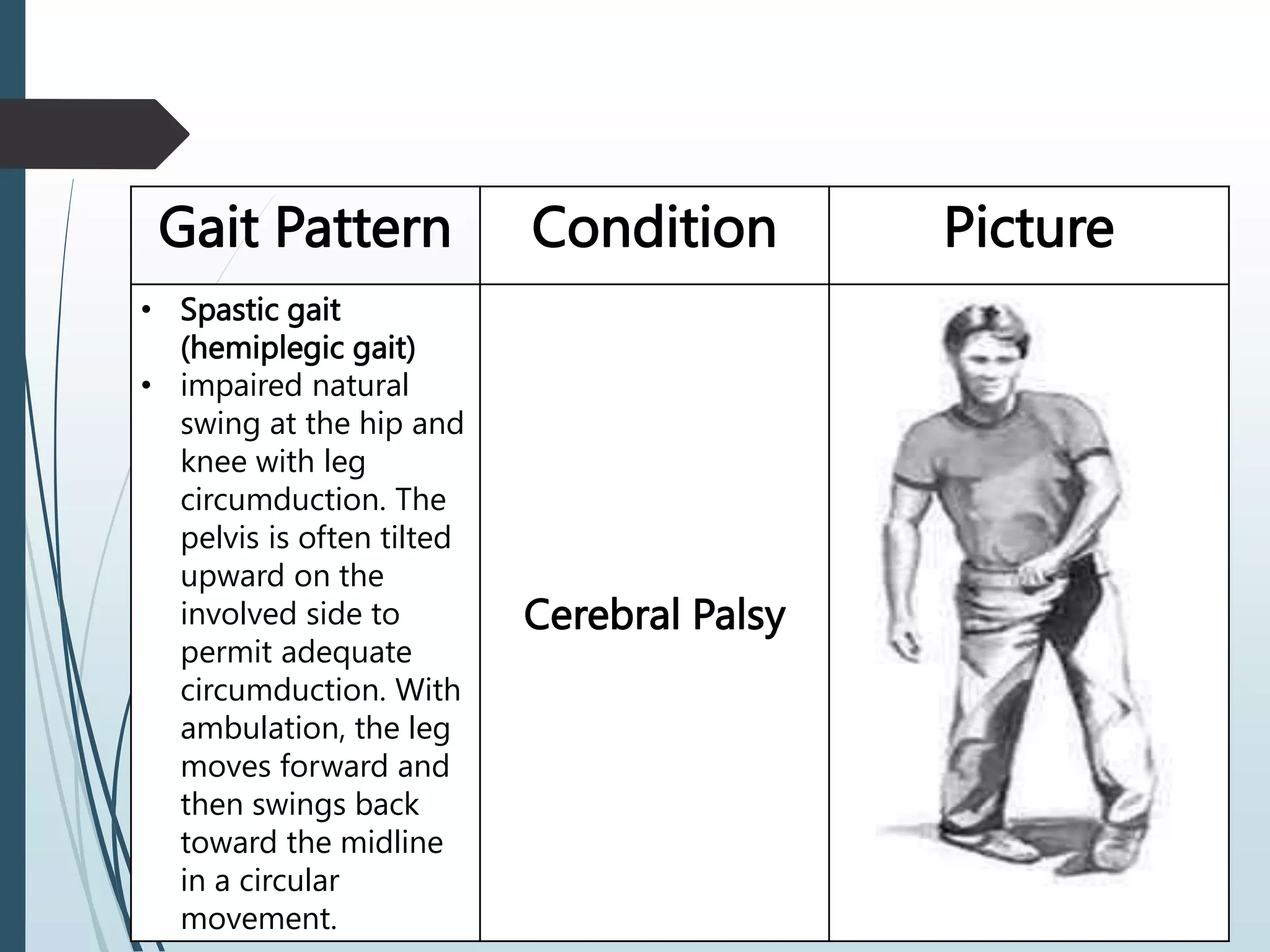 Pathological gaits | PPTX