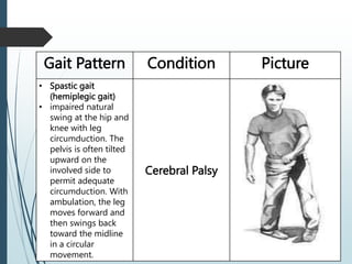 Pathological gaits | PPTX