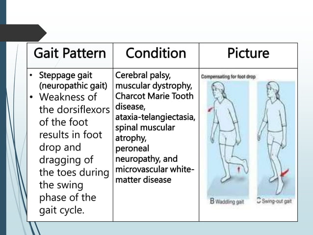Pathological gaits | PPTX