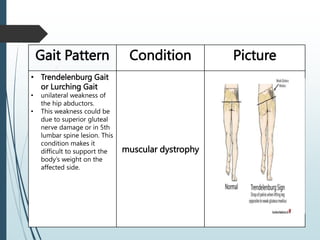Pathological gaits | PPTX