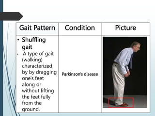 Pathological gaits | PPT