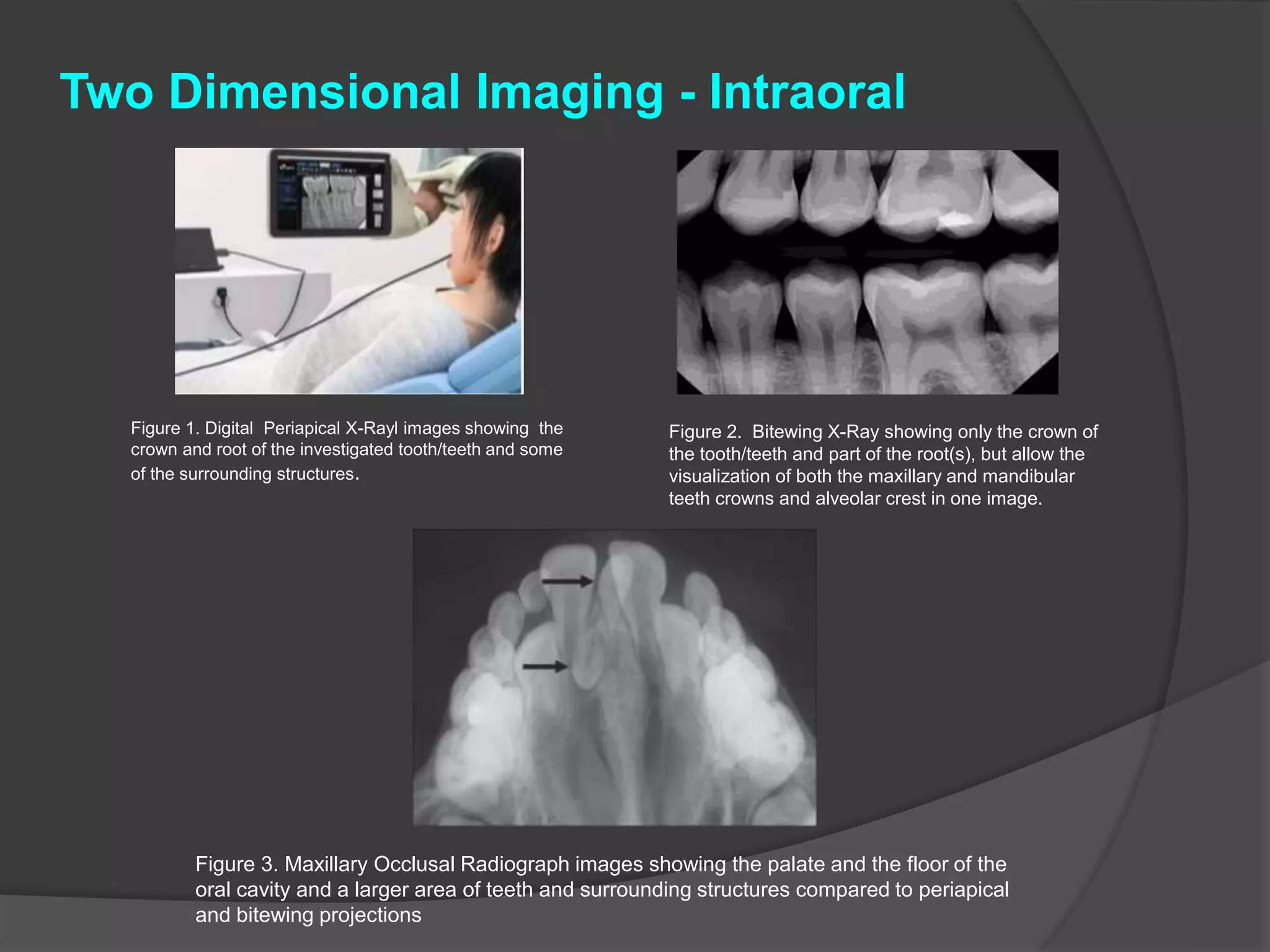 Presentation1.-ADVANCEMENT-IN-DENTAL-RADIOLOGY101.pptx