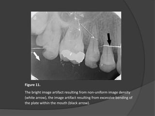Presentation1.-ADVANCEMENT-IN-DENTAL-RADIOLOGY101.pptx