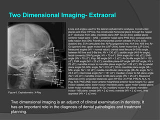 Presentation1.-ADVANCEMENT-IN-DENTAL-RADIOLOGY101.pptx | Dental Health ...