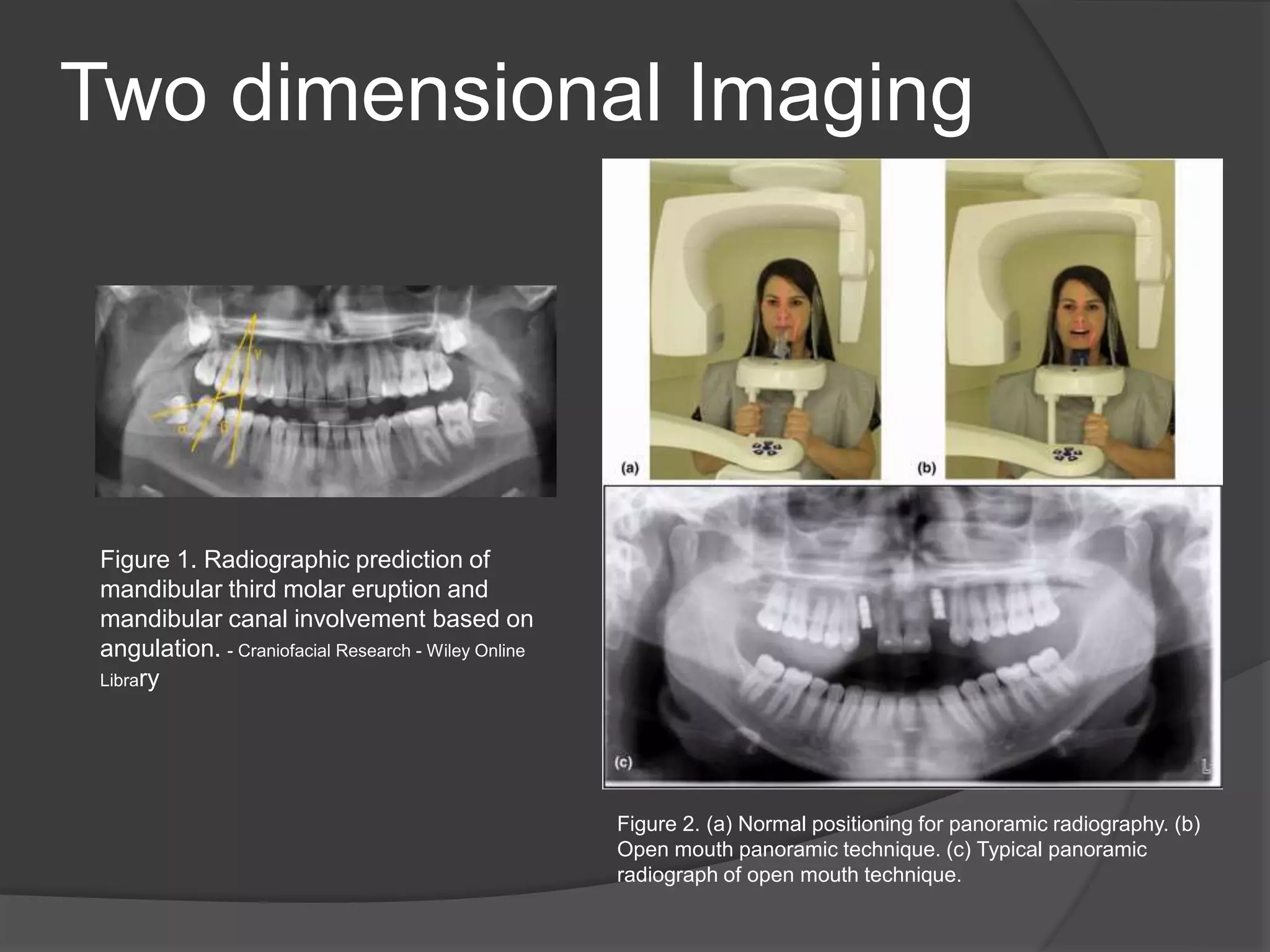 Presentation1.-ADVANCEMENT-IN-DENTAL-RADIOLOGY1.pptx