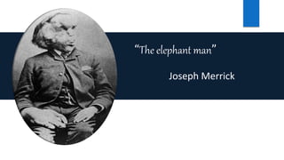 The elephant man story | PPT