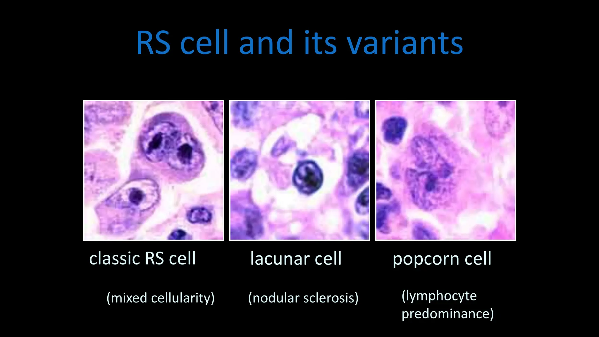 ROUND CELL TUMOR.pptx