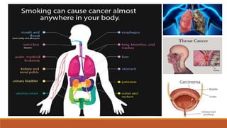National Tobacco control programme NTCP.pptx