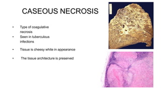 Presentation1 powerpoint necrosis form of cell death | PPTX | Diseases ...