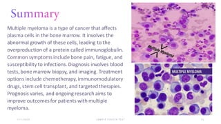MULTIPLE MYELOMA (MM) SLIDESHARE PRESENTATION | PDF
