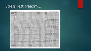 Treadmill Stress Echocardiogram normal.pptx