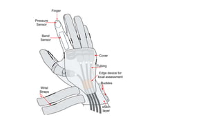 Anatomy of human hand with sensors placed | PPT