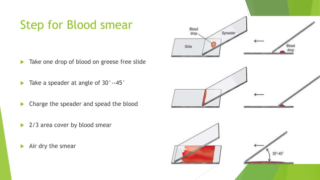Preparation of blood smear | PPTX | Blood Disorders | Diseases and ...