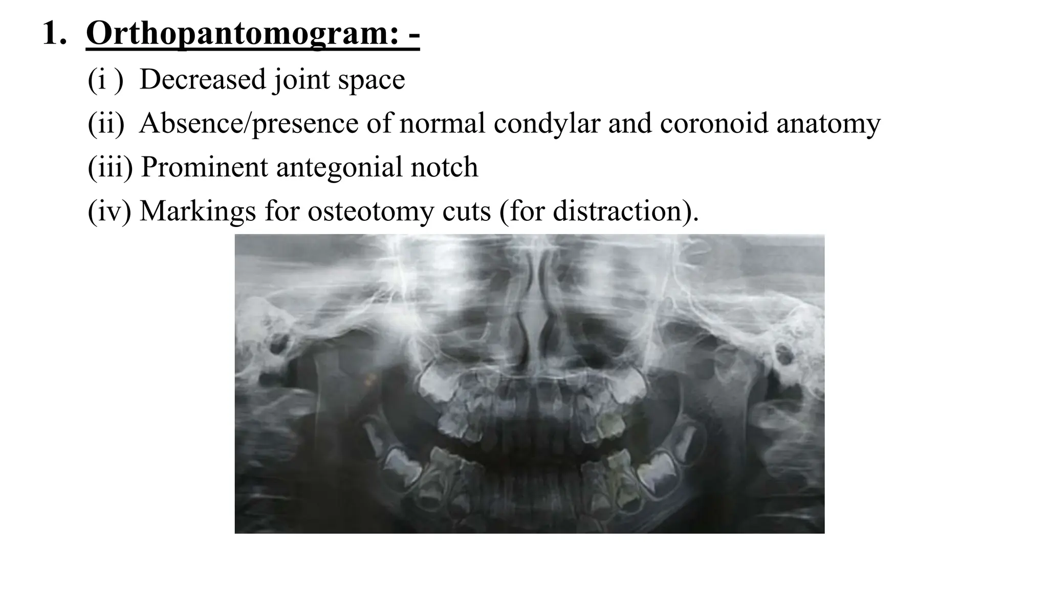 TMJ ANKYLOSIS of the Jaw and its clinical significancies | PPTX