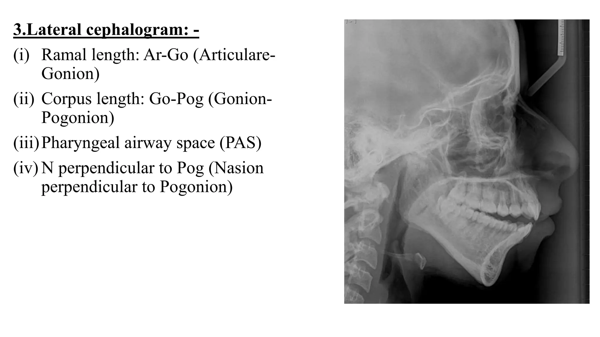 TMJ ANKYLOSIS of the Jaw and its clinical significancies | PPTX