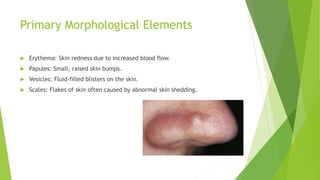 Dermatosis | PPTX