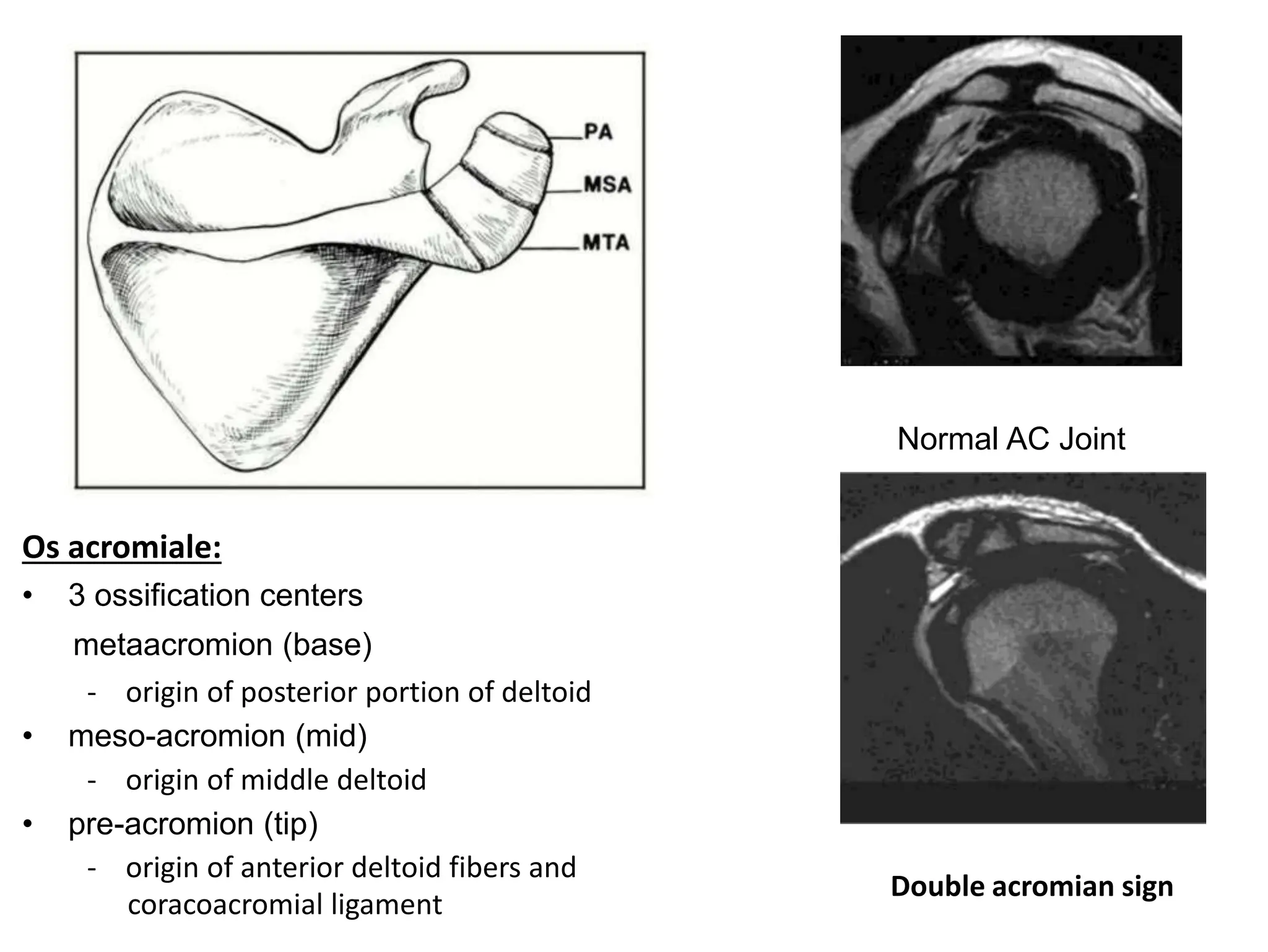 shoulder pathologies MRI: basic anatomy and MRI scans | PPTX