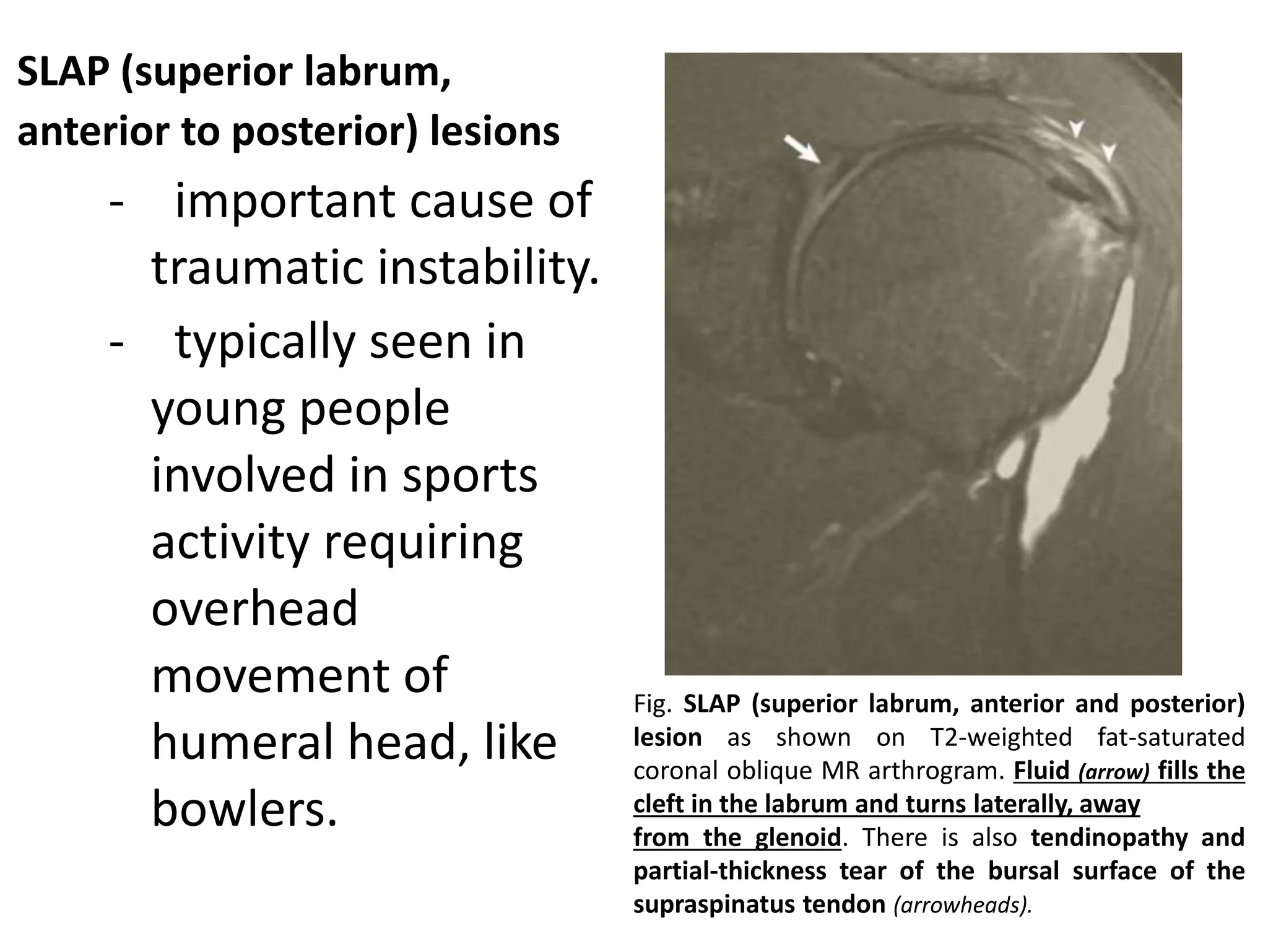 shoulder pathologies MRI: basic anatomy and MRI scans | PPTX