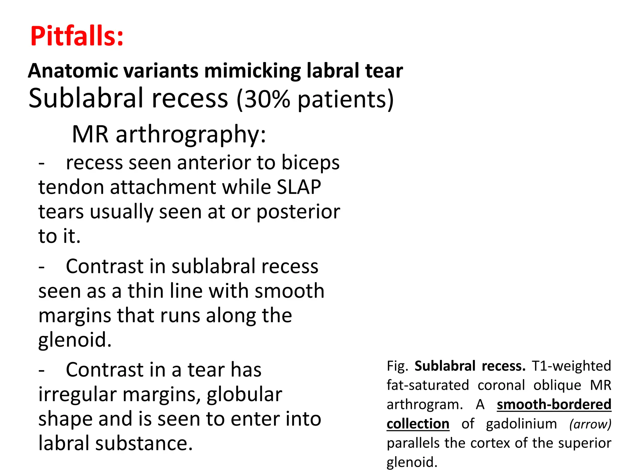 shoulder pathologies MRI: basic anatomy and MRI scans | PPTX