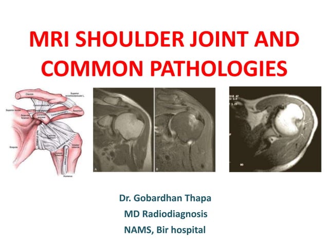 shoulder pathologies MRI: basic anatomy and MRI scans | PPTX