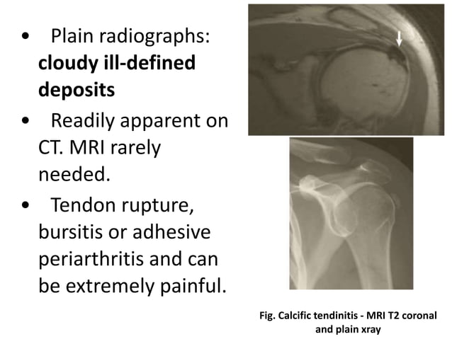 shoulder pathologies MRI: basic anatomy and MRI scans | PPTX