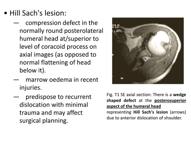 shoulder pathologies MRI: basic anatomy and MRI scans | PPTX