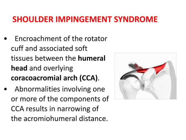 shoulder pathologies MRI: basic anatomy and MRI scans | PPTX