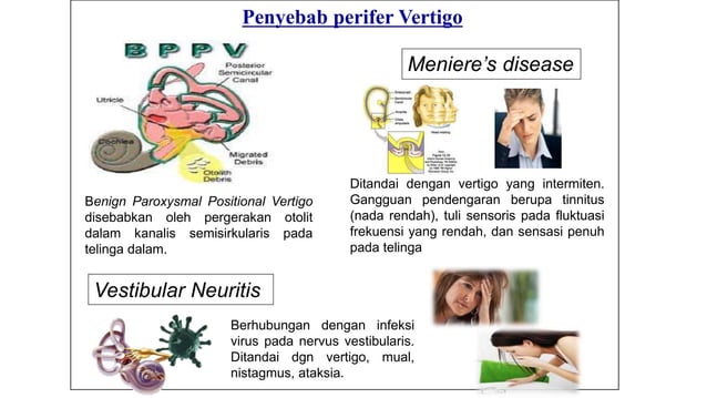 LAPSUS VERTIGO)))))))))))))))))))))))))) | PPT